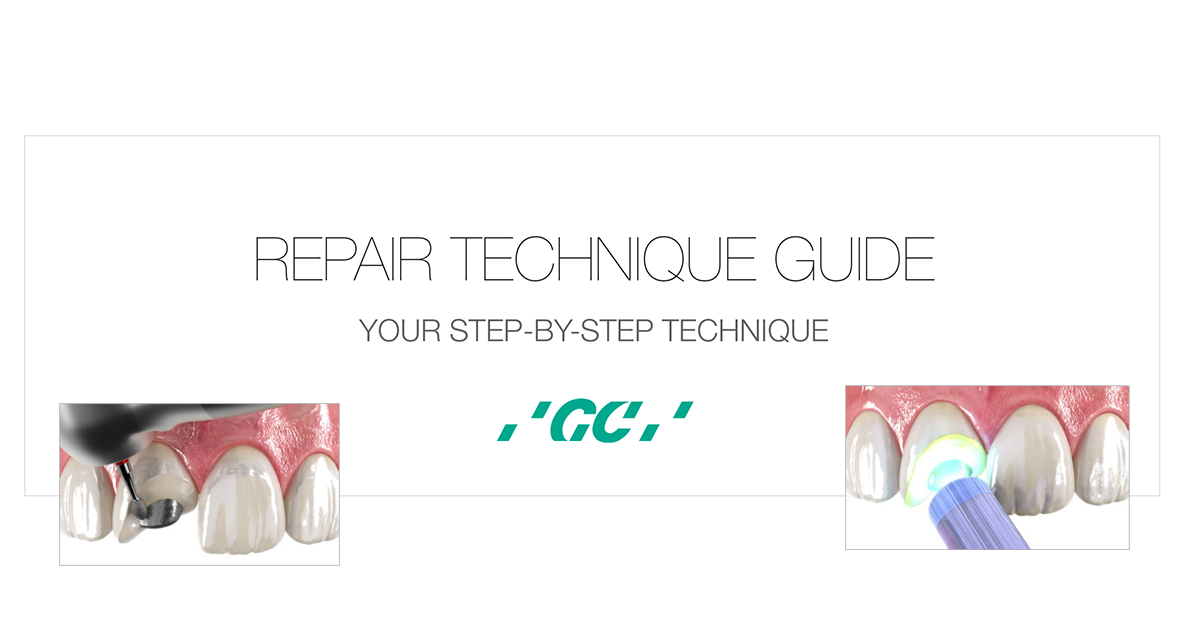 Repair Technique Guide - Your Step-by-step Technique - Henry Schein New ...