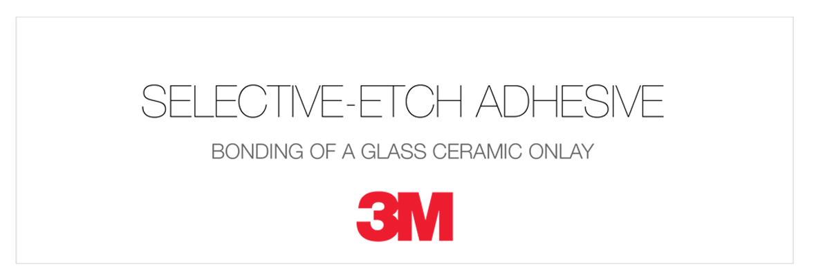 Selective-etch Adhesive Bonding of A Glass Ceramic Onlay - Henry Schein ...
