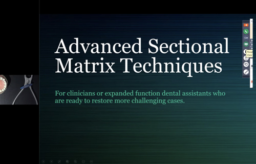 Advanced Sectional Matrix Techniques - Henry Schein New Zealand