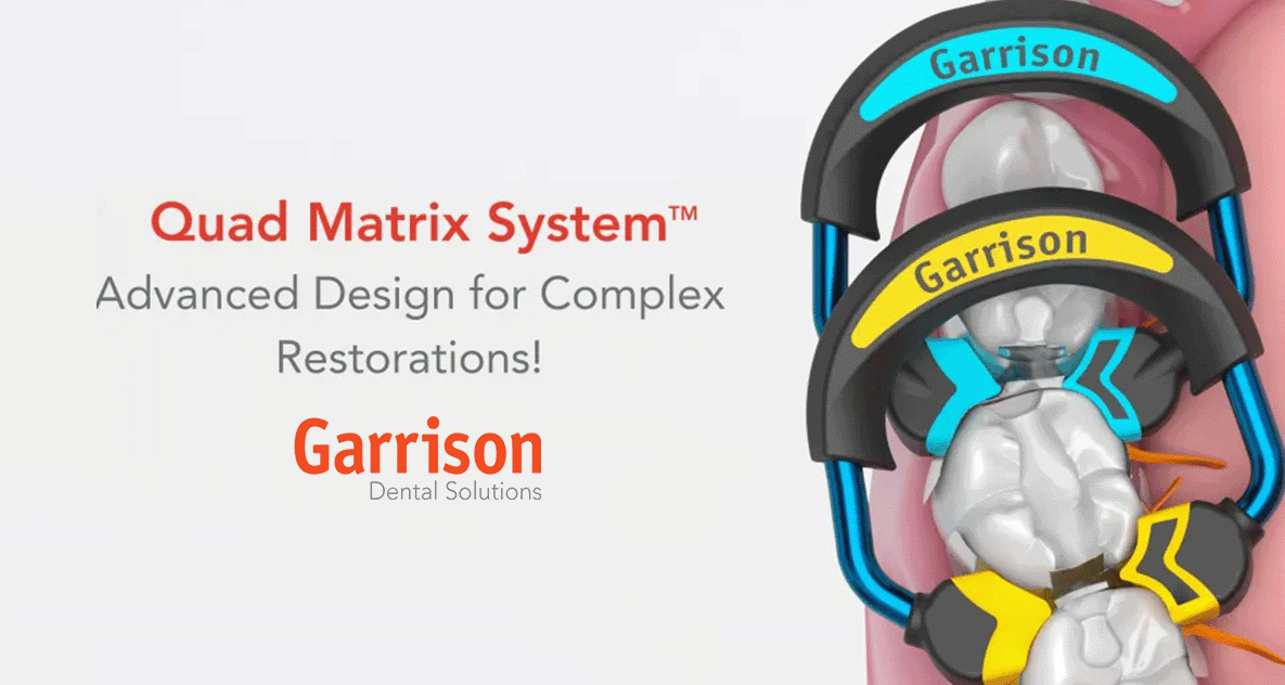 Class II Restorations with the Garrison Quad Matrix System - Henry ...