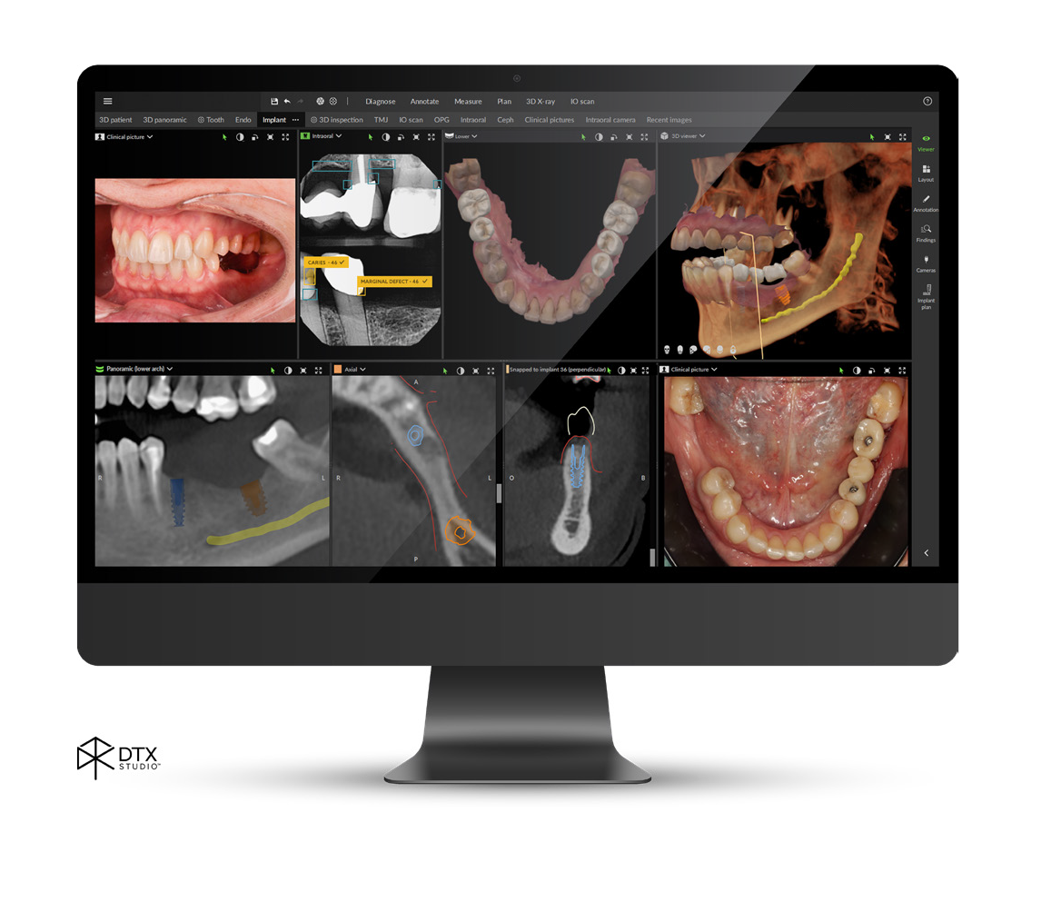Harnessing the Power of 3D X-Ray Imaging - Henry Schein New Zealand