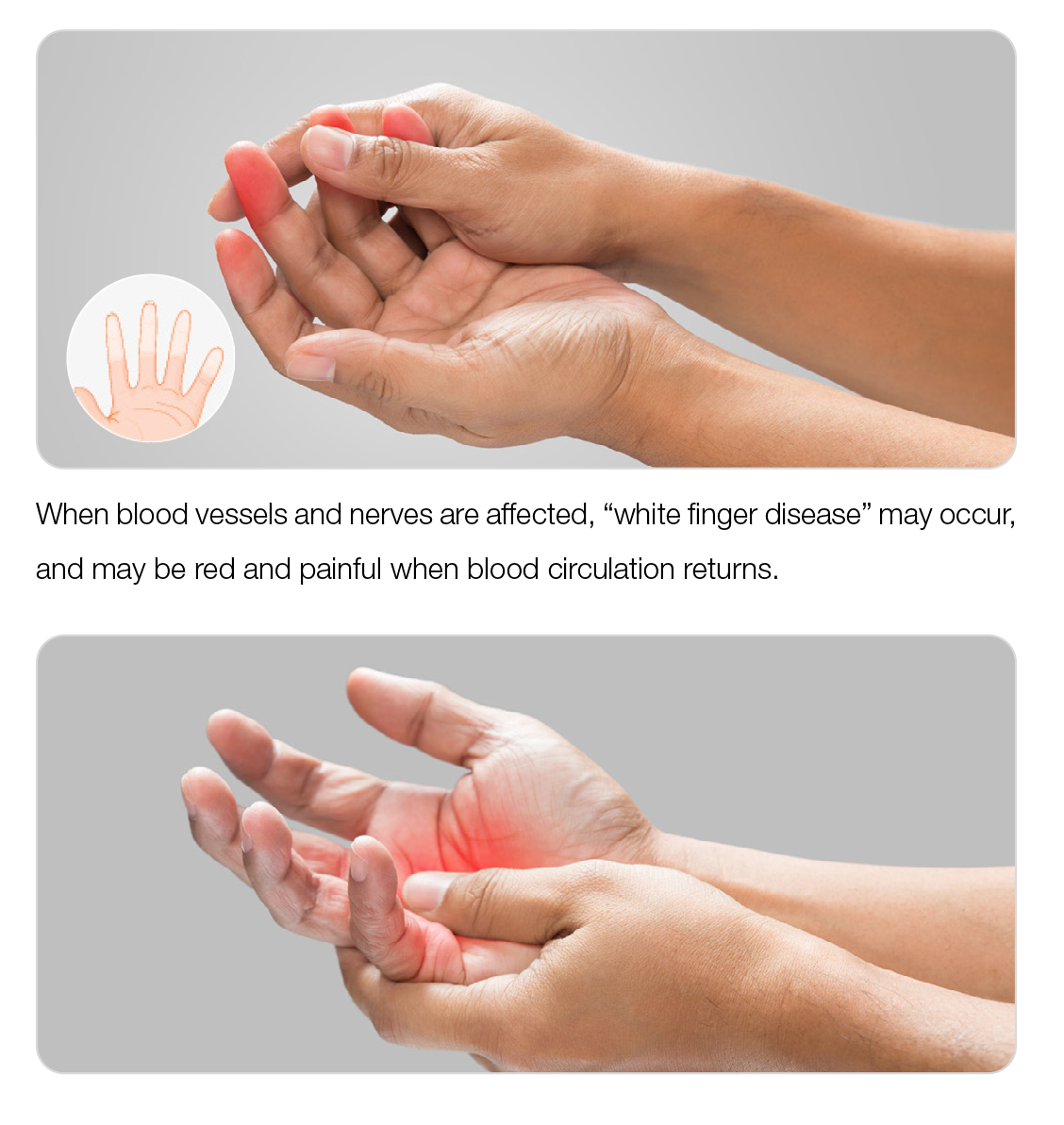 Occupational Hand Disorders in Dentistry - Henry Schein New Zealand