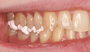 Impression Products - Henry Schein New Zealand